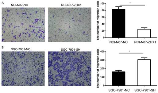 ZHX1 Inhibits Gastric Cancer Cell Growth through Inducing Cell-Cycle ...