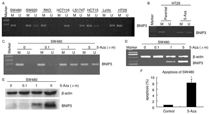 Chemoresistance of colorectal cancer to 5-fluorouracil is associated ...