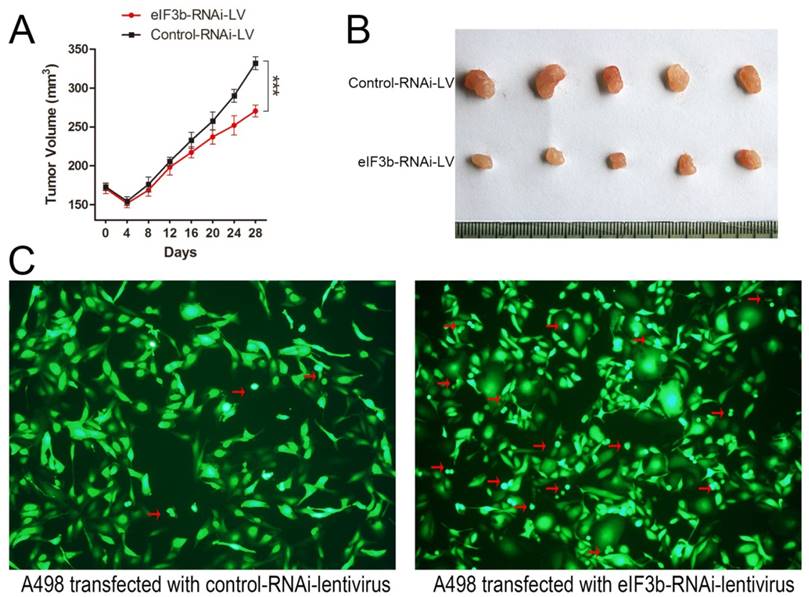 Eukaryotic Translation Initiation Factor 3b is both a Promising ...