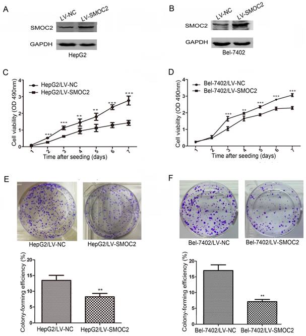 Overexpression of SMOC2 Attenuates the Tumorigenicity of Hepatocellular ...