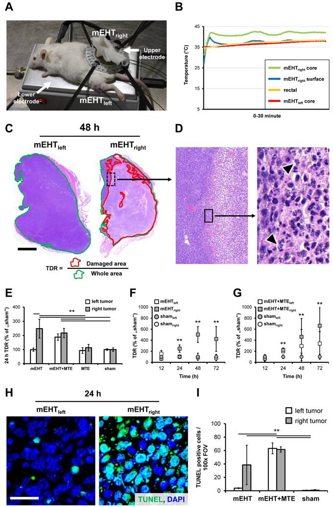 Modulated electro-hyperthermia induced loco-regional and systemic tumor ...