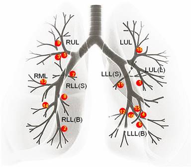 Radial probe endobronchial ultrasound assisted conventional ...