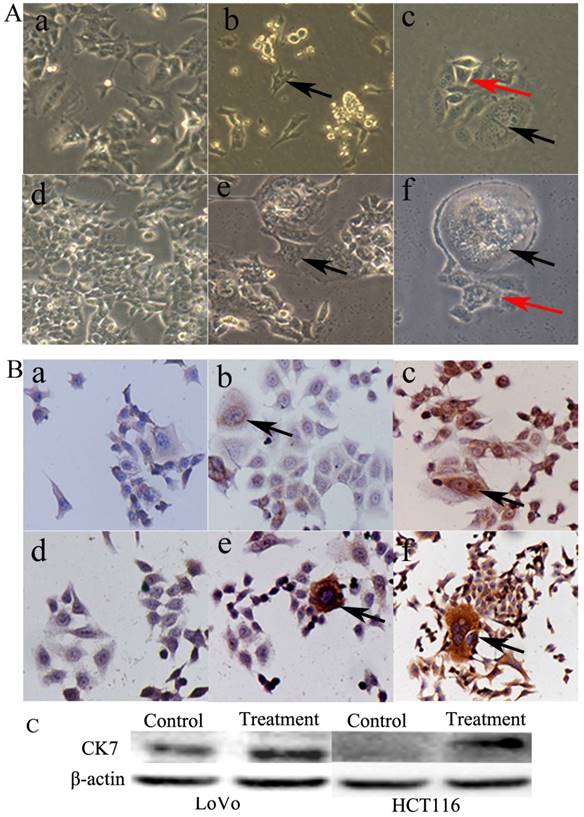 CK7 expression associates with the location, differentiation, lymph ...