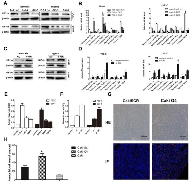 The RNA-binding protein QKI suppresses tumorigenesis of clear cell ...