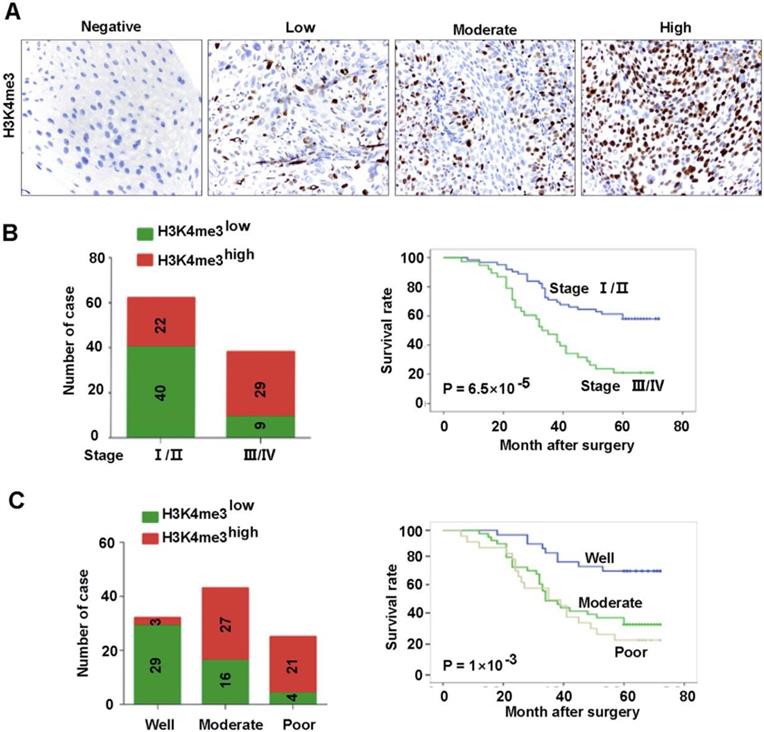 High level of H3K4 tri-methylation modification predicts poor prognosis ...