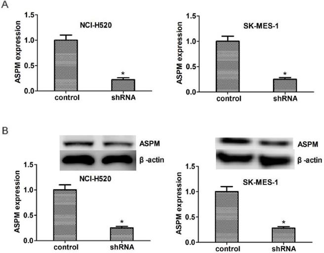 Abnormal spindle-like microcephaly-associated protein (ASPM ...