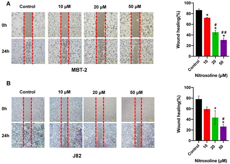 Nitroxoline inhibits bladder cancer progression by reversing EMT ...