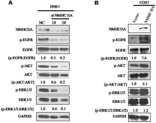 The Overexpression of NMHC IIA Promoted Invasion and Metastasis of ...