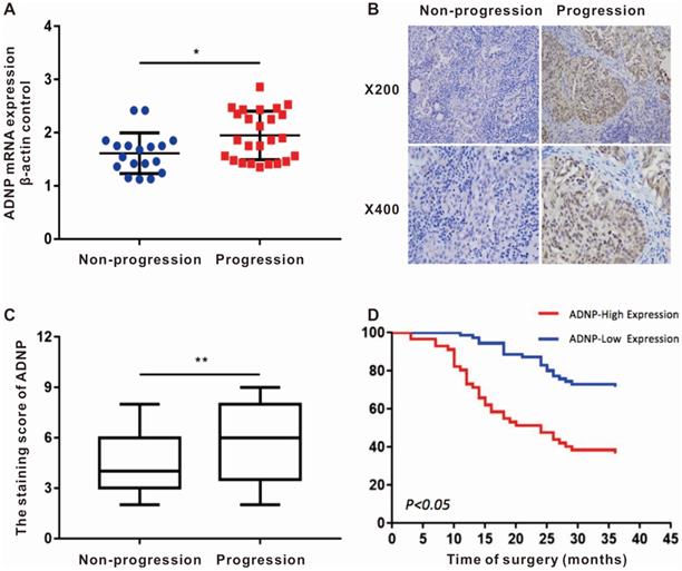 ADNP prompts the cisplatin-resistance of bladder cancer via TGF-β ...