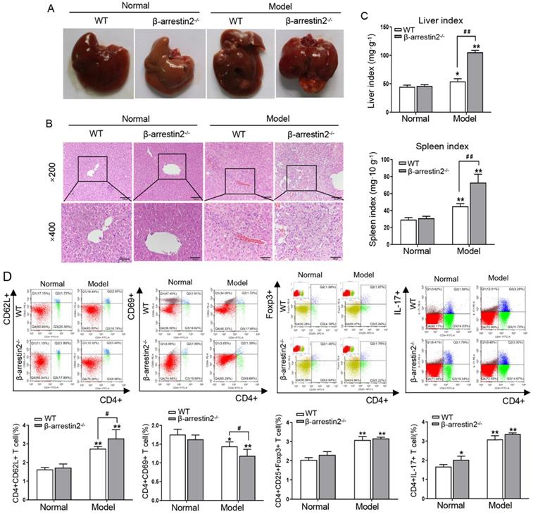 β-arrestin2 regulating β2-adrenergic receptor signaling in hepatic ...