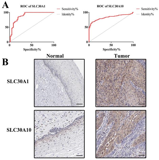 The correlation and role analysis of SLC30A1 and SLC30A10 in cervical ...