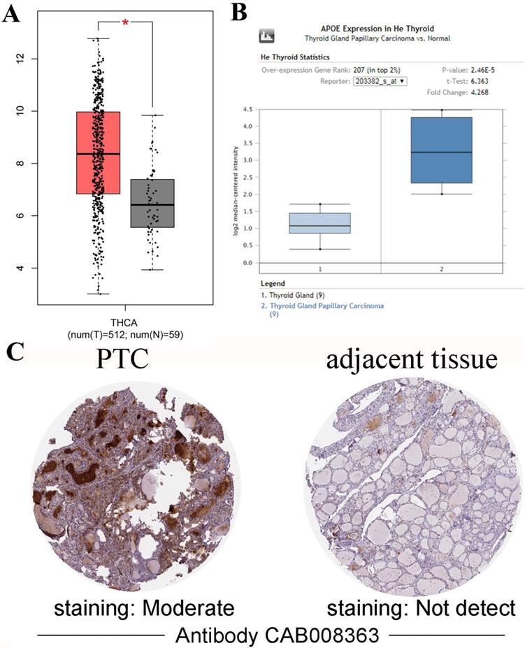 APOE Is a Prognostic Biomarker and Correlates with Immune Infiltrates ...