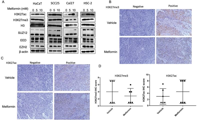 Transcriptional and H3K27ac related genome profiles in oral squamous ...