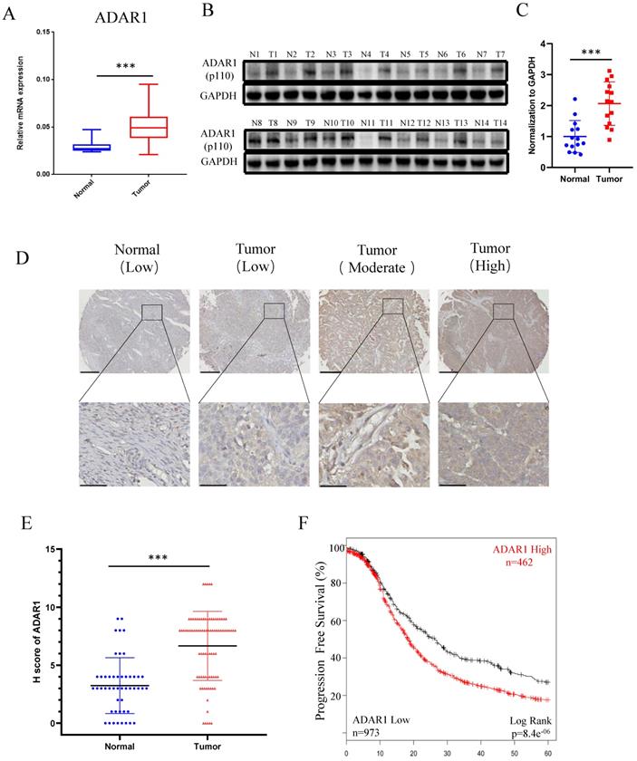 ADAR1 Prevents R-loop Accumulation-Driven ATR Pathway Activation in ...