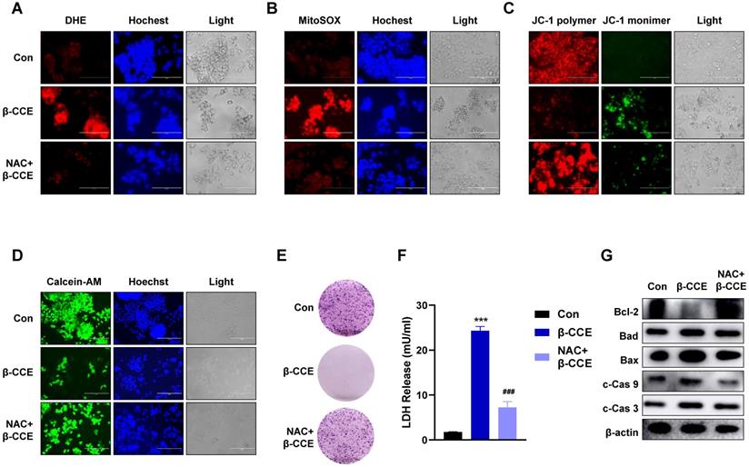 Peroxiredoxin 5 protects HepG2 cells from ethyl β-carboline-3 ...