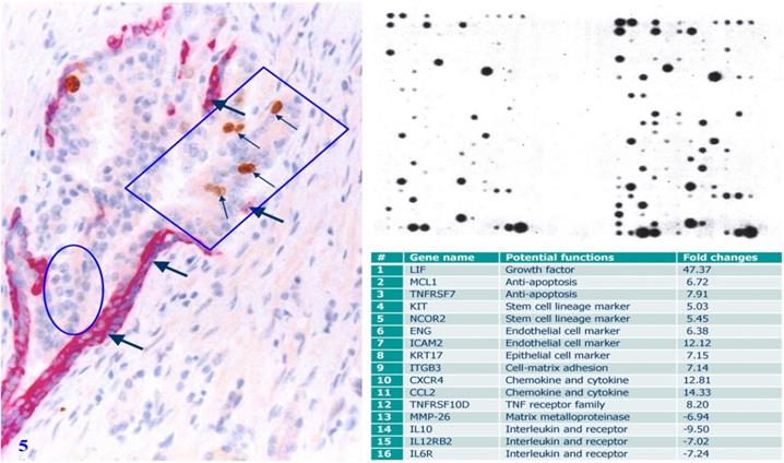 The most effective but largely ignored target for prostate cancer early ...