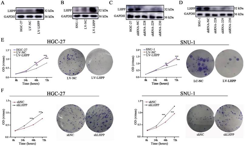 LHPP suppresses gastric cancer progression via the PI3K/AKT/mTOR ...