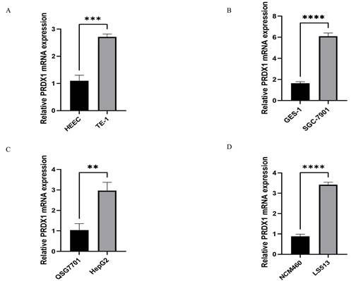 Expression And Prognostic Role of PRDX1 In Gastrointestinal Cancers