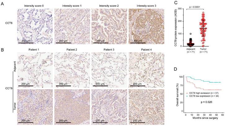 CCT8 promotes cell migration and tumor metastasis in lung adenocarcinomas
