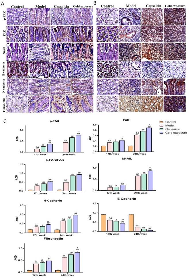 Capsaicin and Cold exposure promote EMT-mediated premetastatic niche ...
