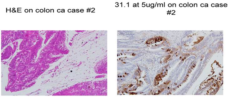 Nanocytology vs. Immunohistochemistry of Intestinal Colonocytes to ...