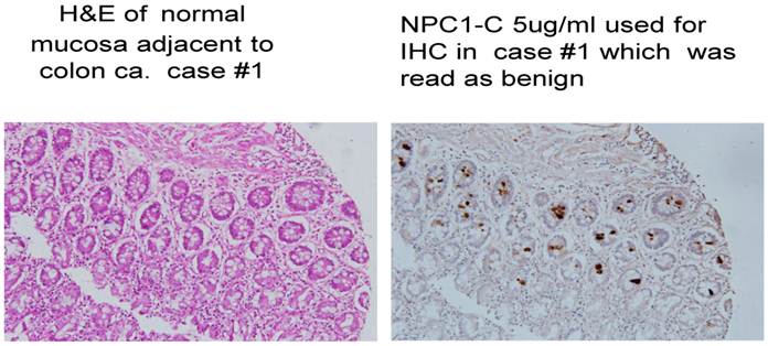 Nanocytology vs. Immunohistochemistry of Intestinal Colonocytes to ...