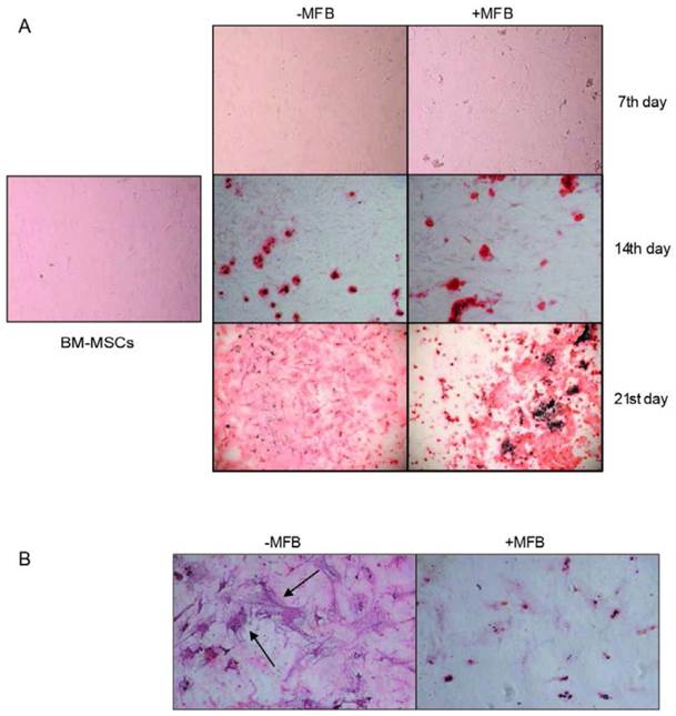 The Analysis of the Relationship between Multiple Myeloma Cells and ...