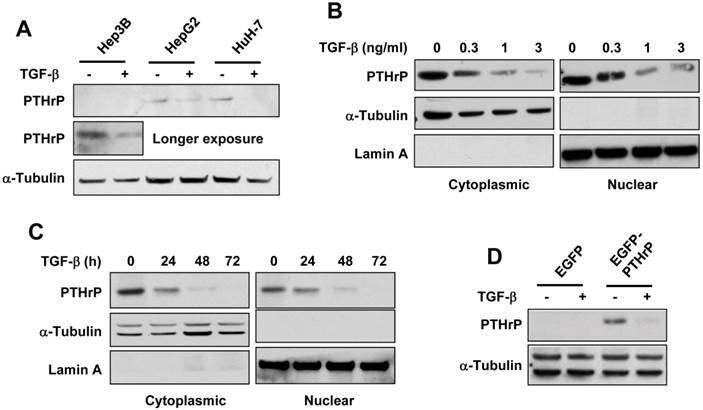 TGF-β Induces Degradation of PTHrP Through Ubiquitin-Proteasome System ...