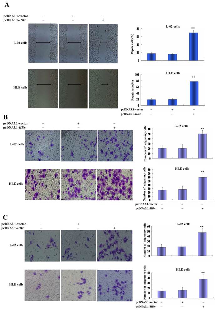 Hepatitis B Virus X Protein Driven Alpha Fetoprotein Expression to ...