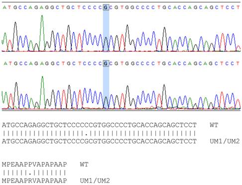 The Expression Levels of XLF and Mutant P53 Are Inversely Correlated in ...