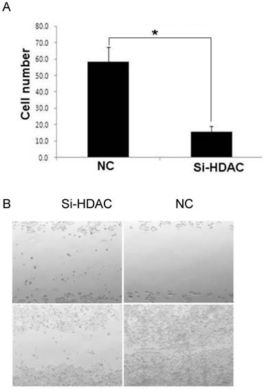 Lentivirus-mediated Knockdown of HDAC1 Uncovers Its Role in Esophageal ...