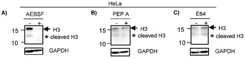 Low Proteolytic Clipping of Histone H3 in Cervical Cancer