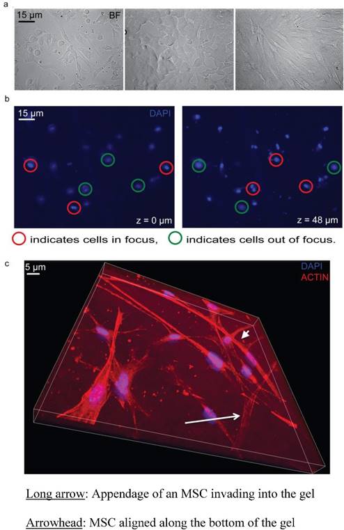 An In Vitro Inverted Vertical Invasion Assay to Avoid Manipulation of ...