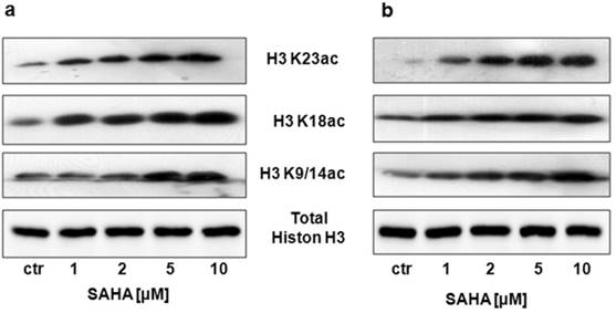 Histone Deacetylase Inhibitor SAHA as Potential Targeted Therapy Agent ...