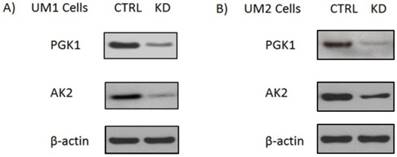 Metabolomic analysis of human oral cancer cells with adenylate kinase 2 ...