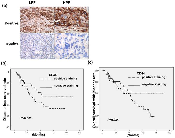 Impact of CD44 expression on radiation response for bladder cancer