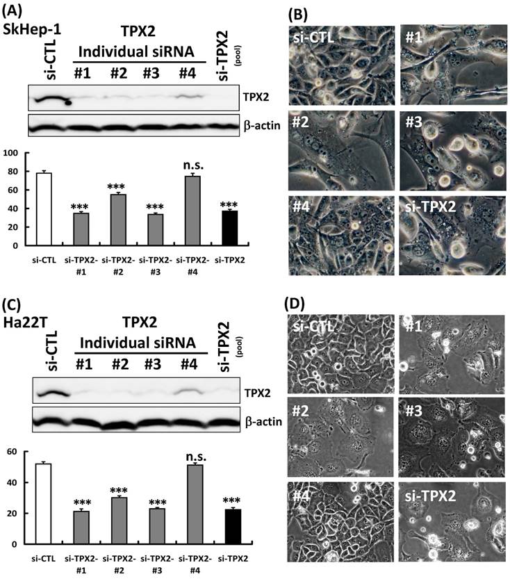 Targeting TPX2 Suppresses the Tumorigenesis of Hepatocellular Carcinoma ...