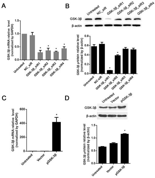GSK-3β suppresses HCC cell dissociation in vitro by upregulating ...