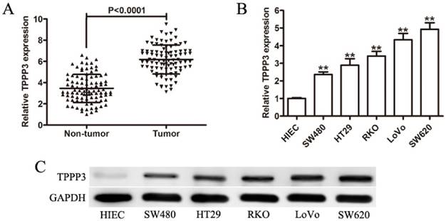 Knockdown of Tubulin Polymerization Promoting Protein Family Member 3 ...