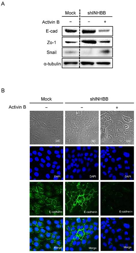 Activin B Regulates Adhesion, Invasiveness, and Migratory Activities in ...