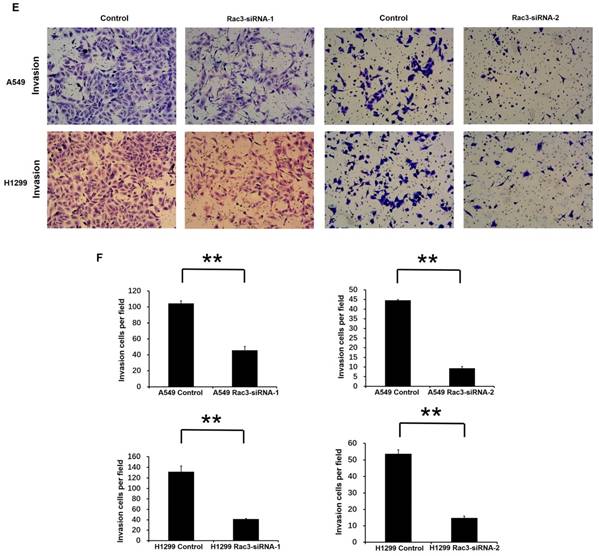 Rac3 Regulates Cell Invasion, Migration and EMT in Lung Adenocarcinoma ...