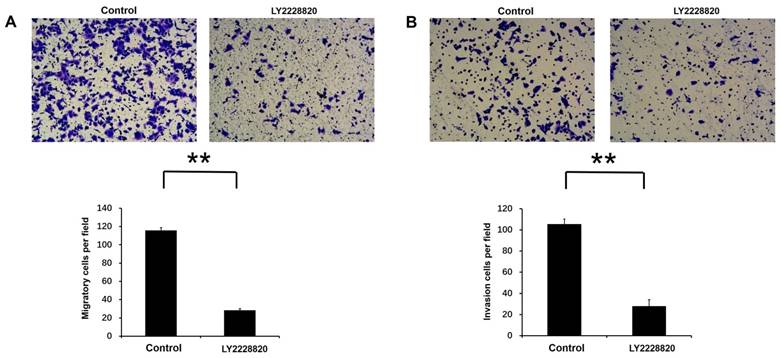 Rac3 Regulates Cell Invasion, Migration and EMT in Lung Adenocarcinoma ...