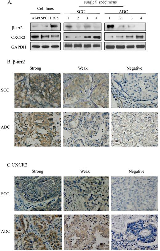 Loss of β-arrestin-2 and Activation of CXCR2 Correlate with Lymph Node ...