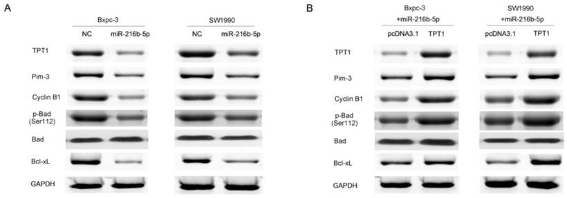 MicroRNA-216b-5p Functions as a Tumor-suppressive RNA by Targeting TPT1 ...