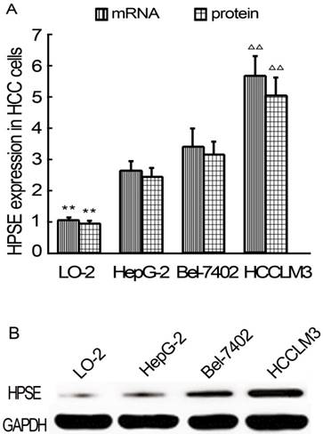 Heparanase Contributes To Trans-Endothelial Migration of Hepatocellular ...