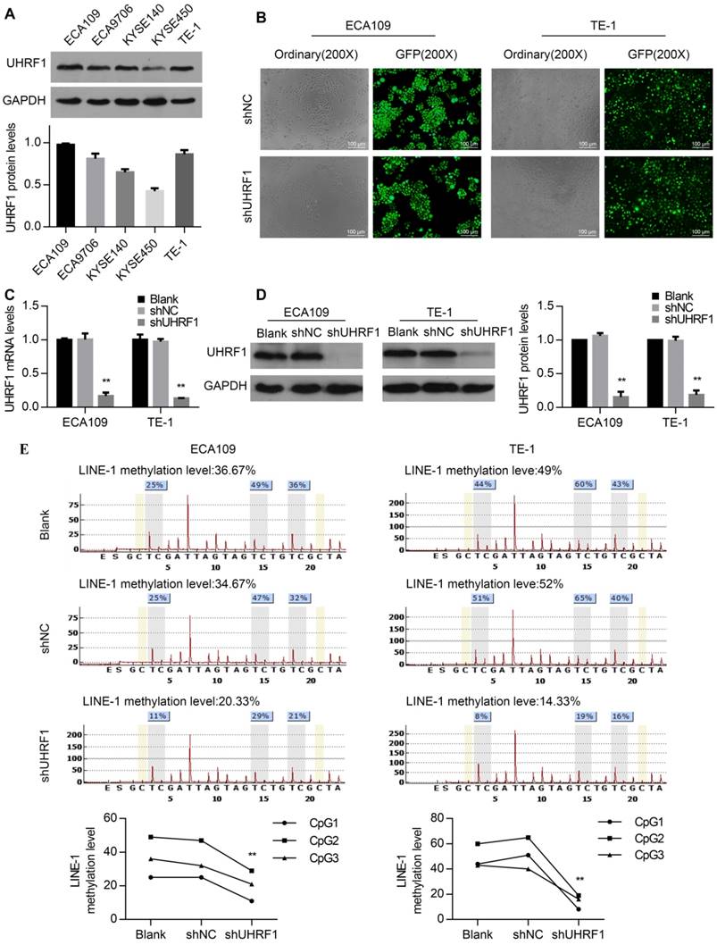 UHRF1 is an Independent Prognostic Factor and a Potential Therapeutic ...