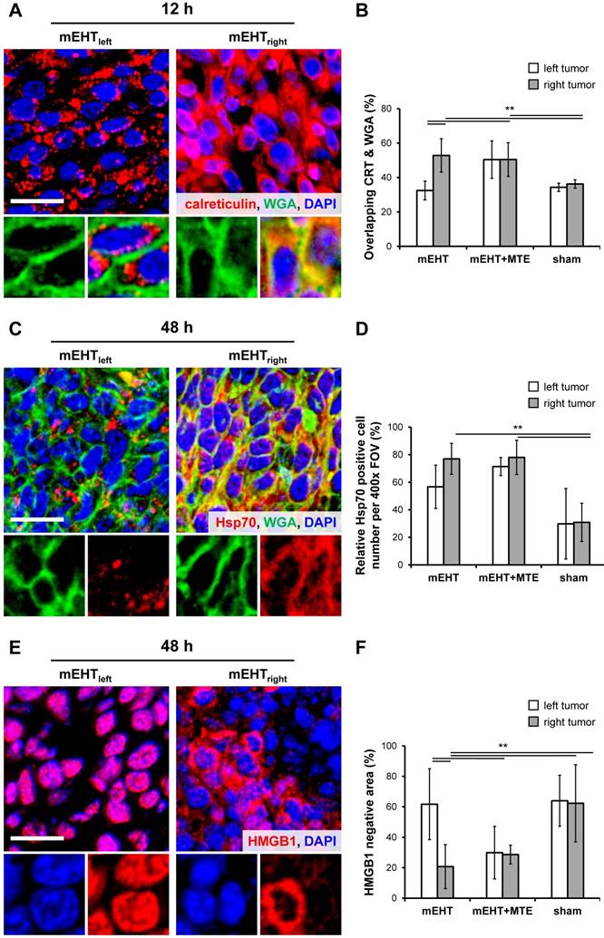 Modulated electro-hyperthermia induced loco-regional and systemic tumor ...