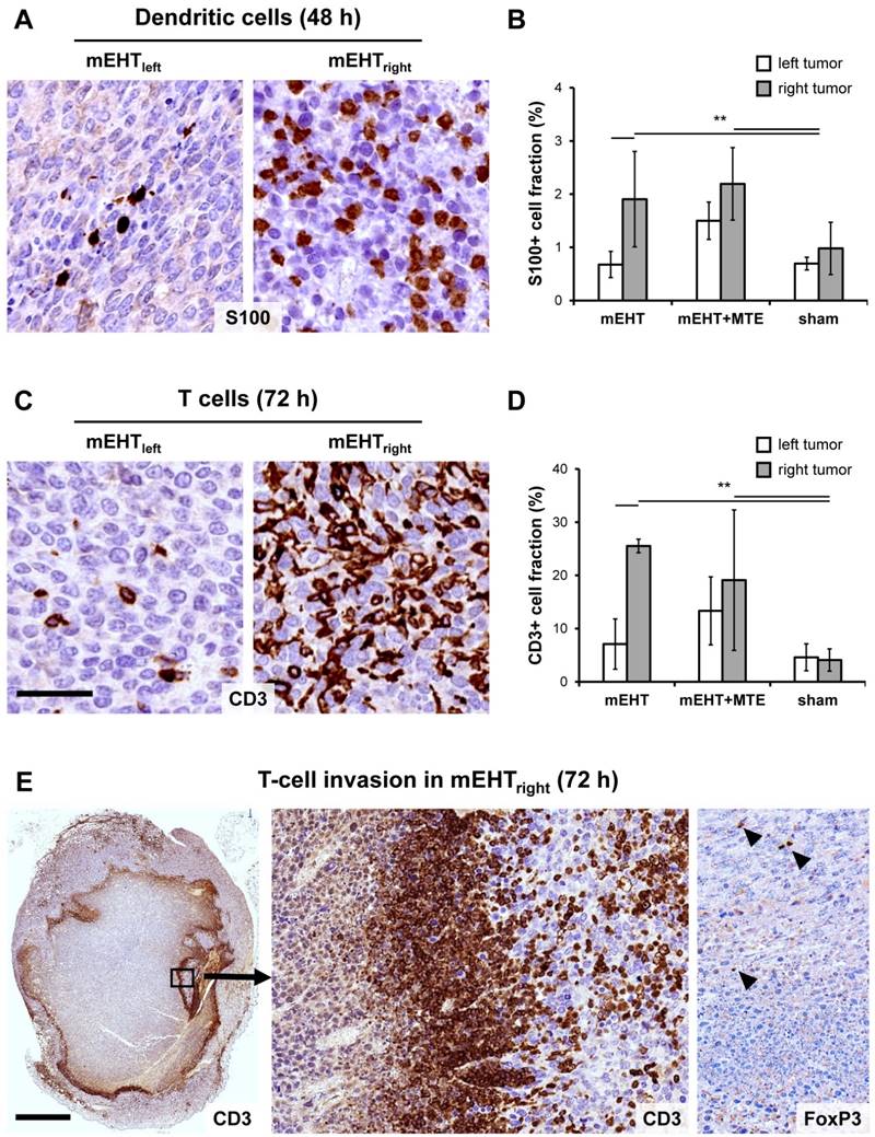 Modulated electro-hyperthermia induced loco-regional and systemic tumor ...
