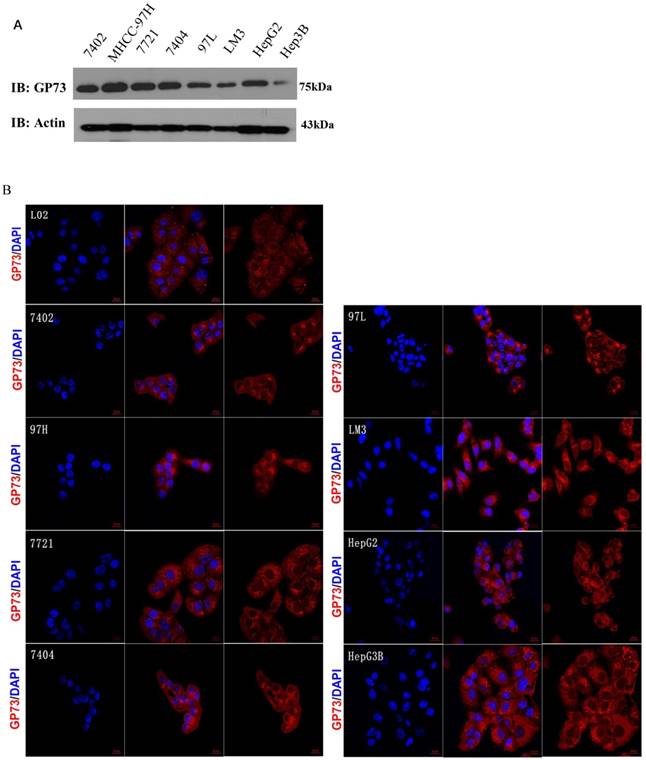 GP73 level determines chemotherapeutic resistance in human ...