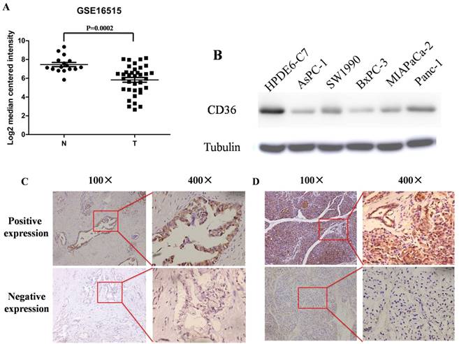 Down-expression of CD36 in pancreatic adenocarcinoma and its ...